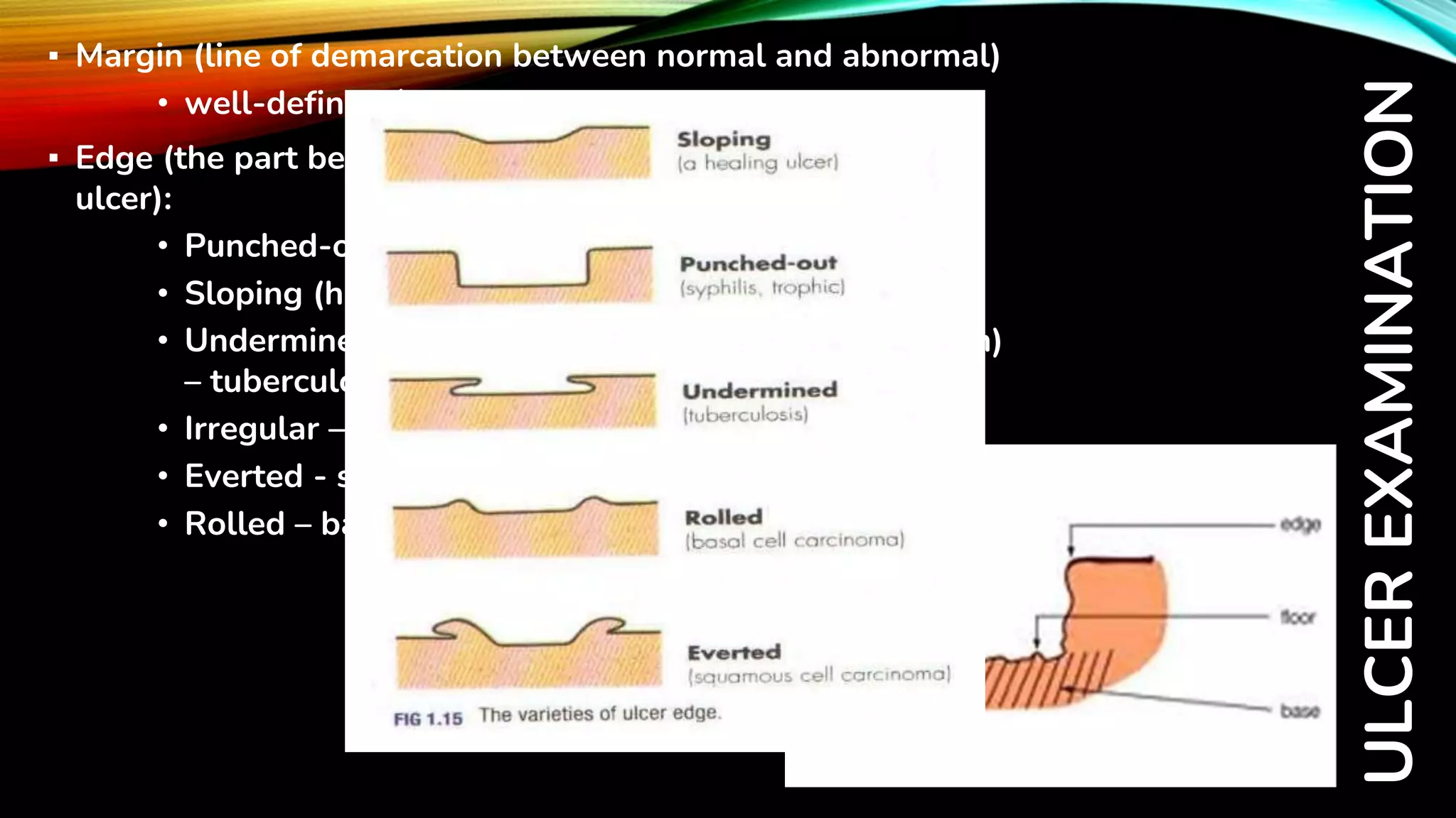 DIABETIC FOOT & STI seminar.pptx