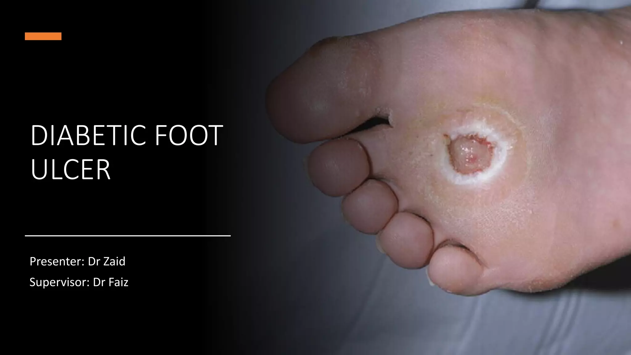 DIABETIC FOOT ULCER.pptx