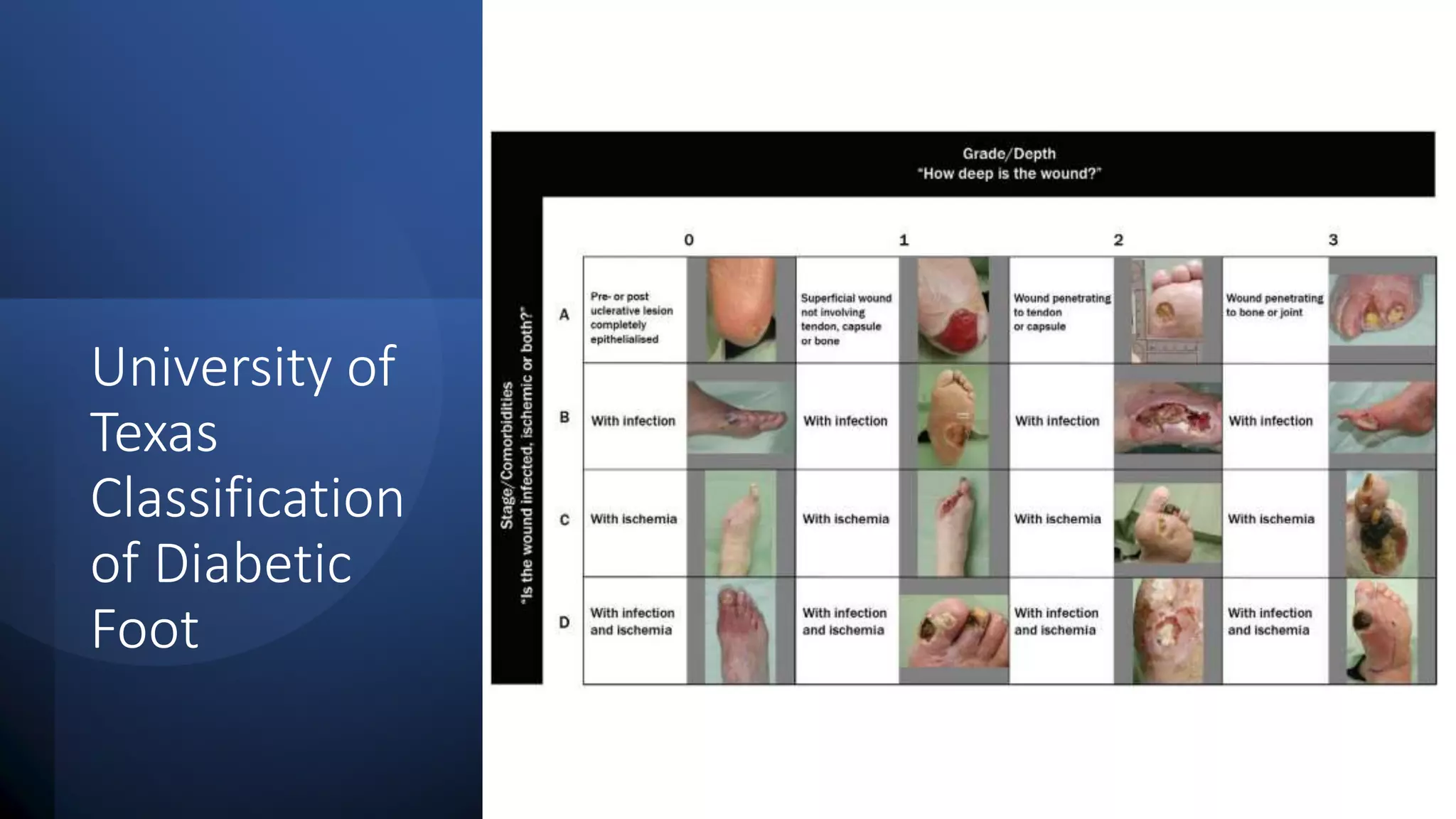 DIABETIC FOOT ULCER.pptx