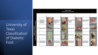 DIABETIC FOOT ULCER.pptx