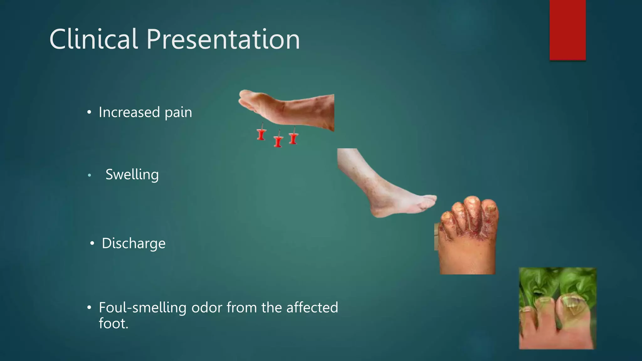 Diabetic Foot Ulcer.pptx