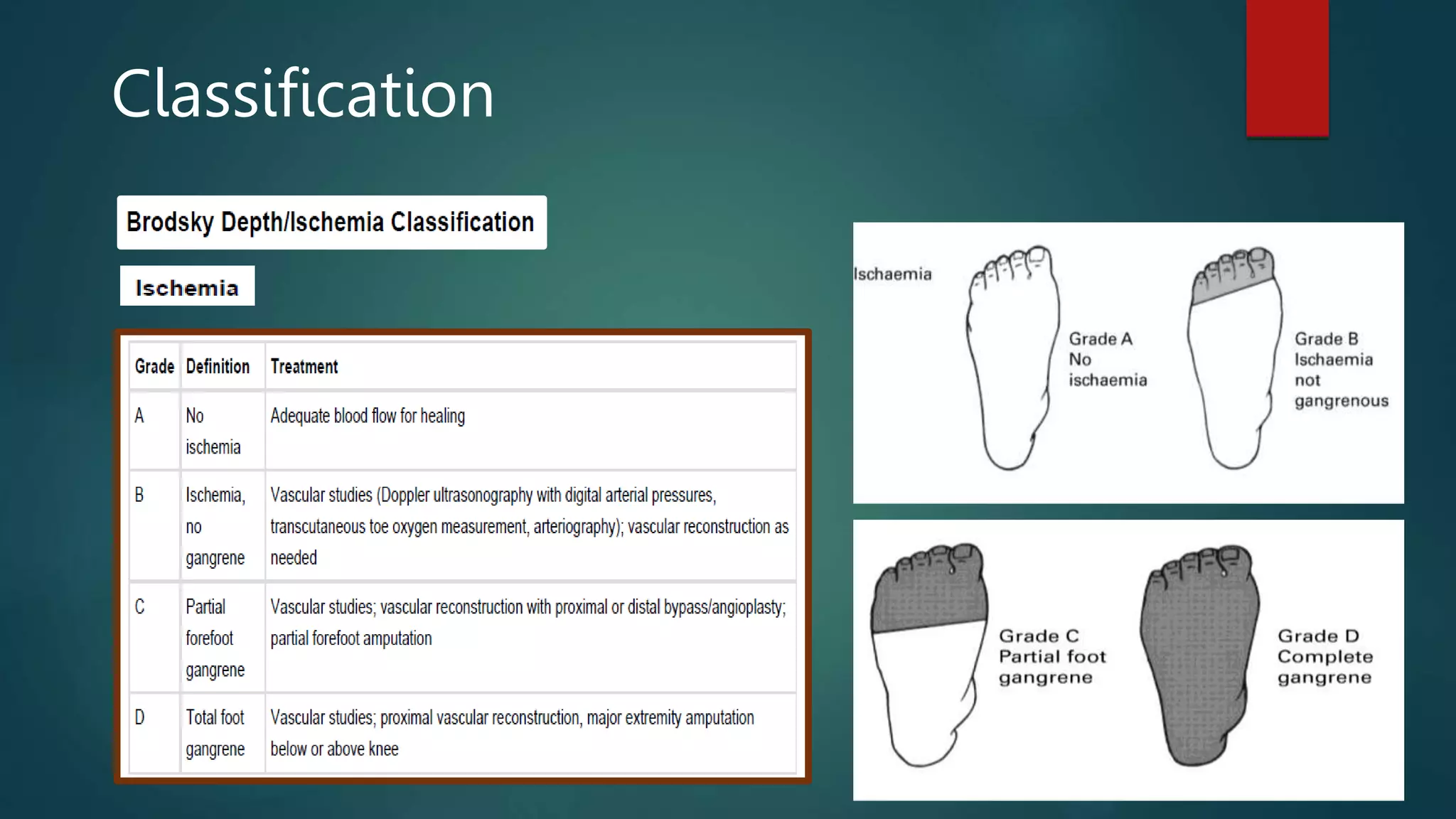 Diabetic Foot Ulcer.pptx