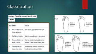 Diabetic Foot Ulcer.pptx