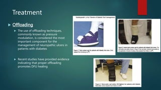 Diabetic Foot Ulcer.pptx