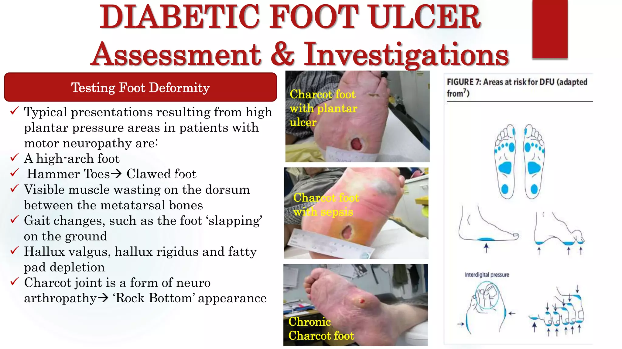 Diabetic foot ulcer / surgical wounds | PPTX
