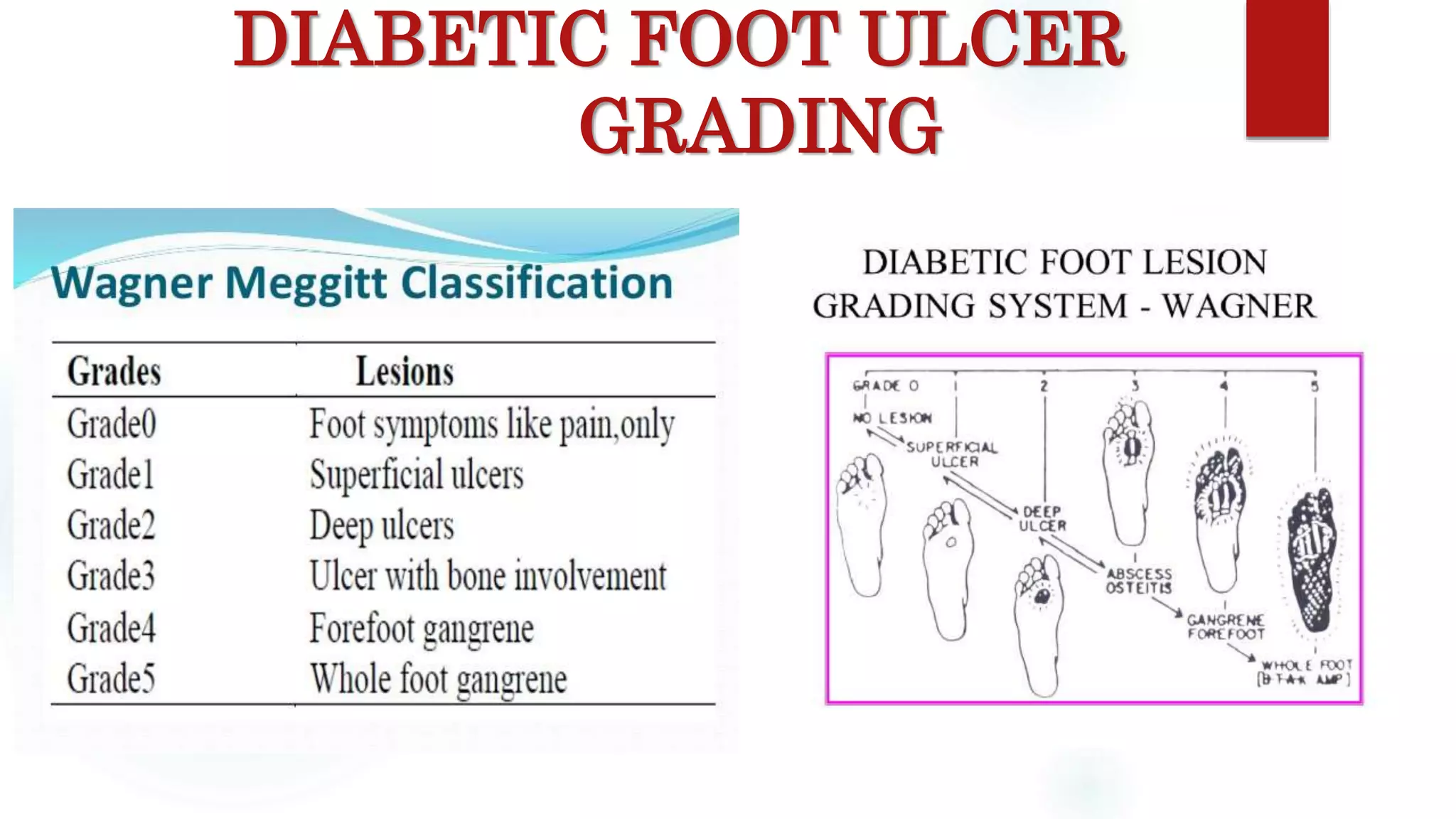 Diabetic foot ulcer / surgical wounds | PPTX