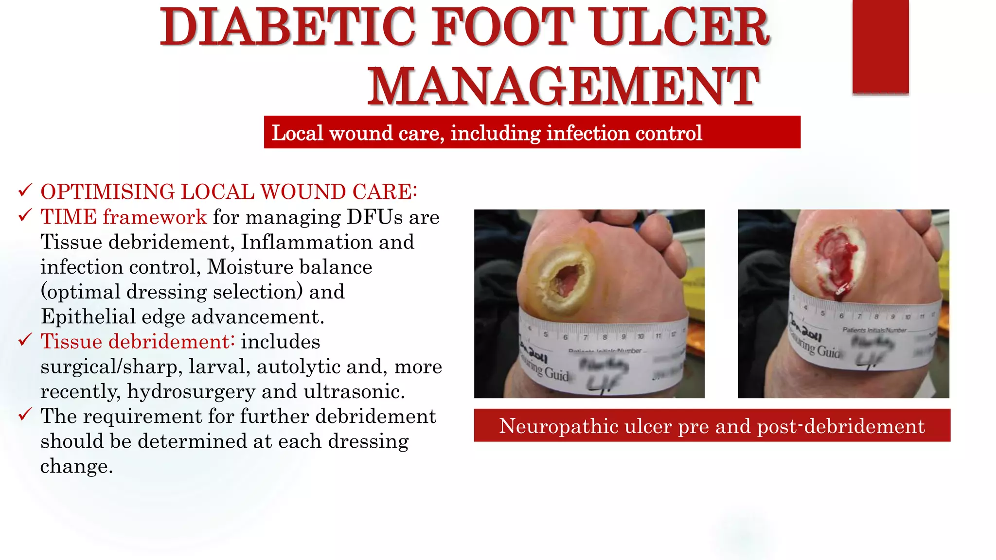 Diabetic foot ulcer / surgical wounds | PPTX