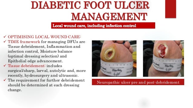 Diabetic foot ulcer / surgical wounds