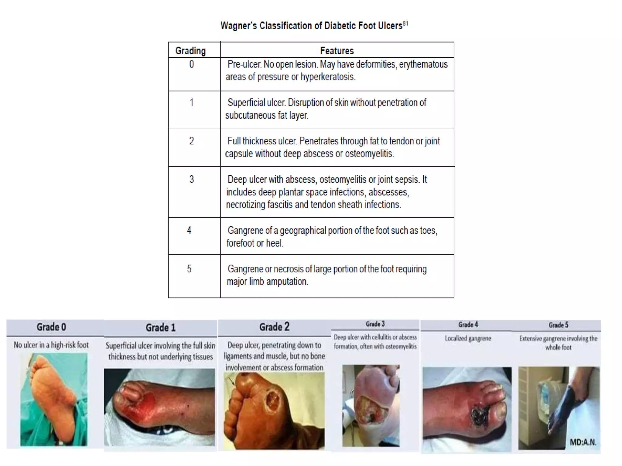 DIABETIC FOOT ULCER AND SOFT TISSUE INFECTIONS-converted.pdf