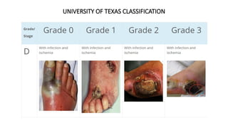 Diabetic Foot Ulcer Classification System - Texa s and Wagner.pptx