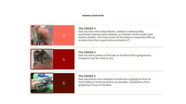 Diabetic Foot Ulcer Classification System - Texa s and Wagner.pptx