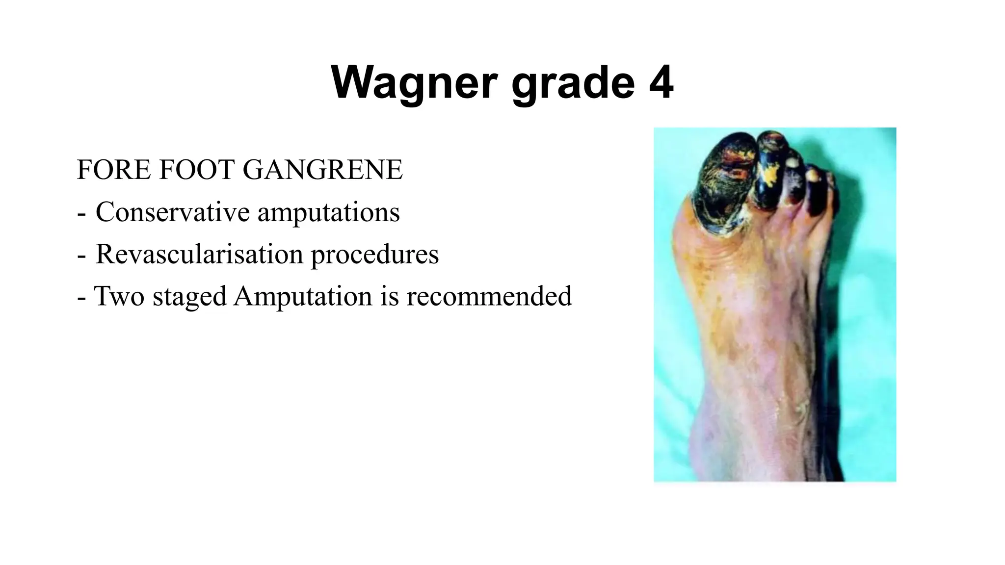 diabetic foot ulcer management skill.pptx