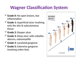 DIABETIC FOOT ULCER clinical features and management | PPTX