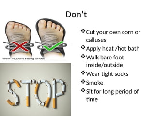DIABETIC FOOT ULCER clinical features and management | PPTX