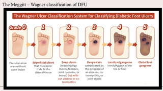 Diabetic foot ulcers: A brief introduction | PPTX