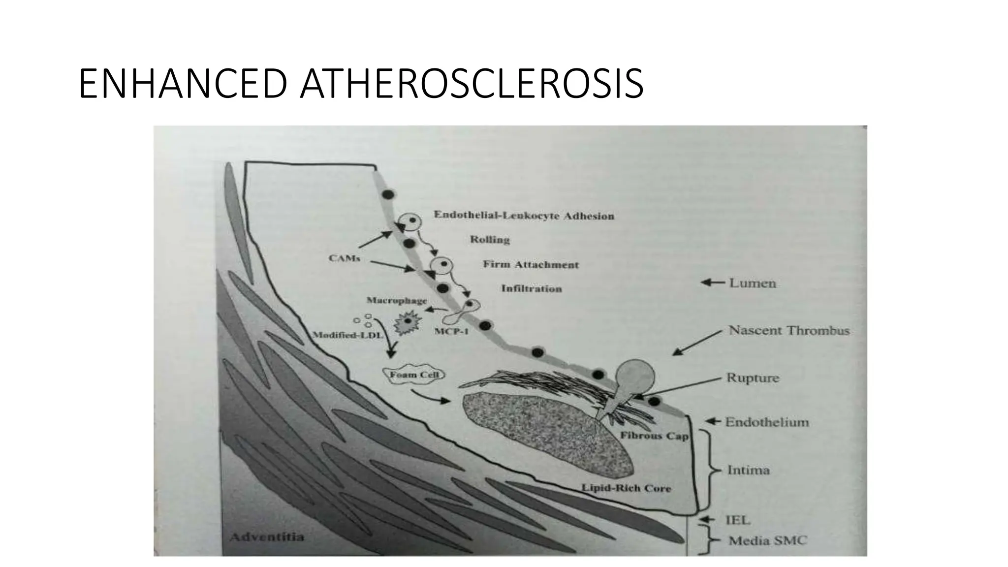 Macrovascular Complications of Diabetes | PPTX