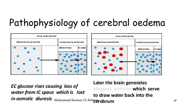 Diabetic ketoacidosis