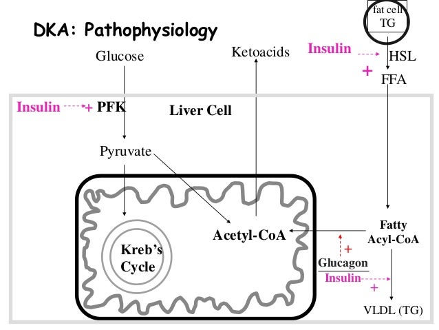 Diabetic ketoacidosis