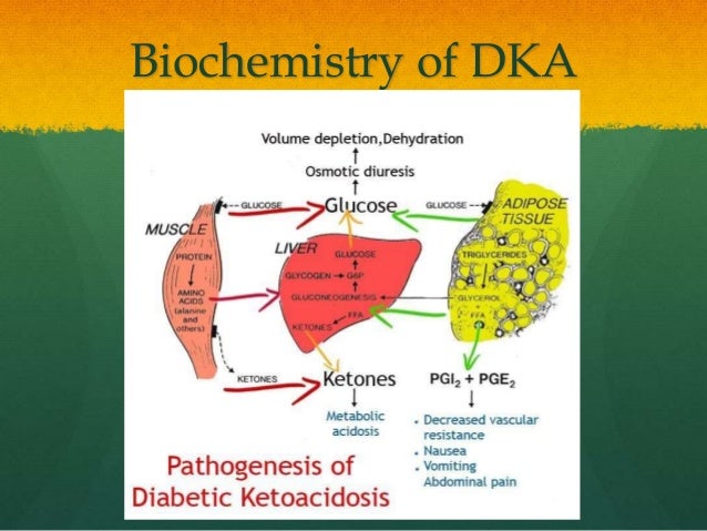 Diabetic ketoacidosis