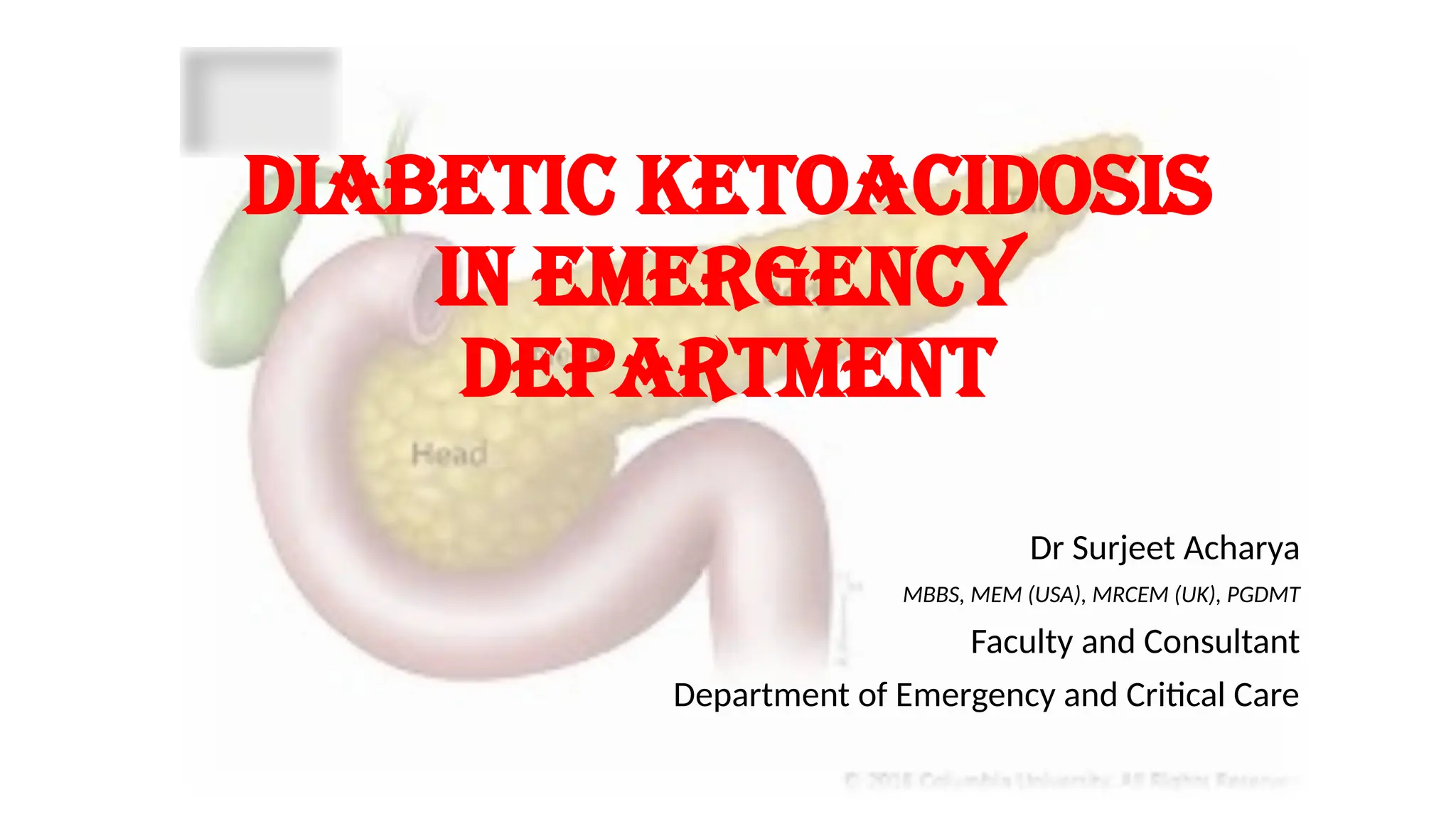 DIABETIC KETOACIDOSIS management in EMERGENCY DEPARTMENT | PPTX