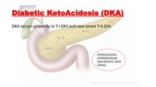 DIABETIC KETOACIDOSIS management in EMERGENCY DEPARTMENT | PPTX