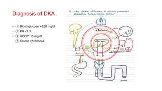DIABETIC KETOACIDOSIS final. Present by Dr Nasir Uddin | PPT