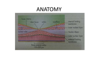 Diabetic Macular Edema | PPTX