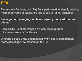 Diabetic macular edema | PPTX