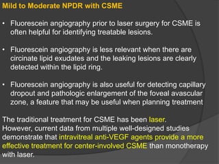 Diabetic macular edema | PPTX