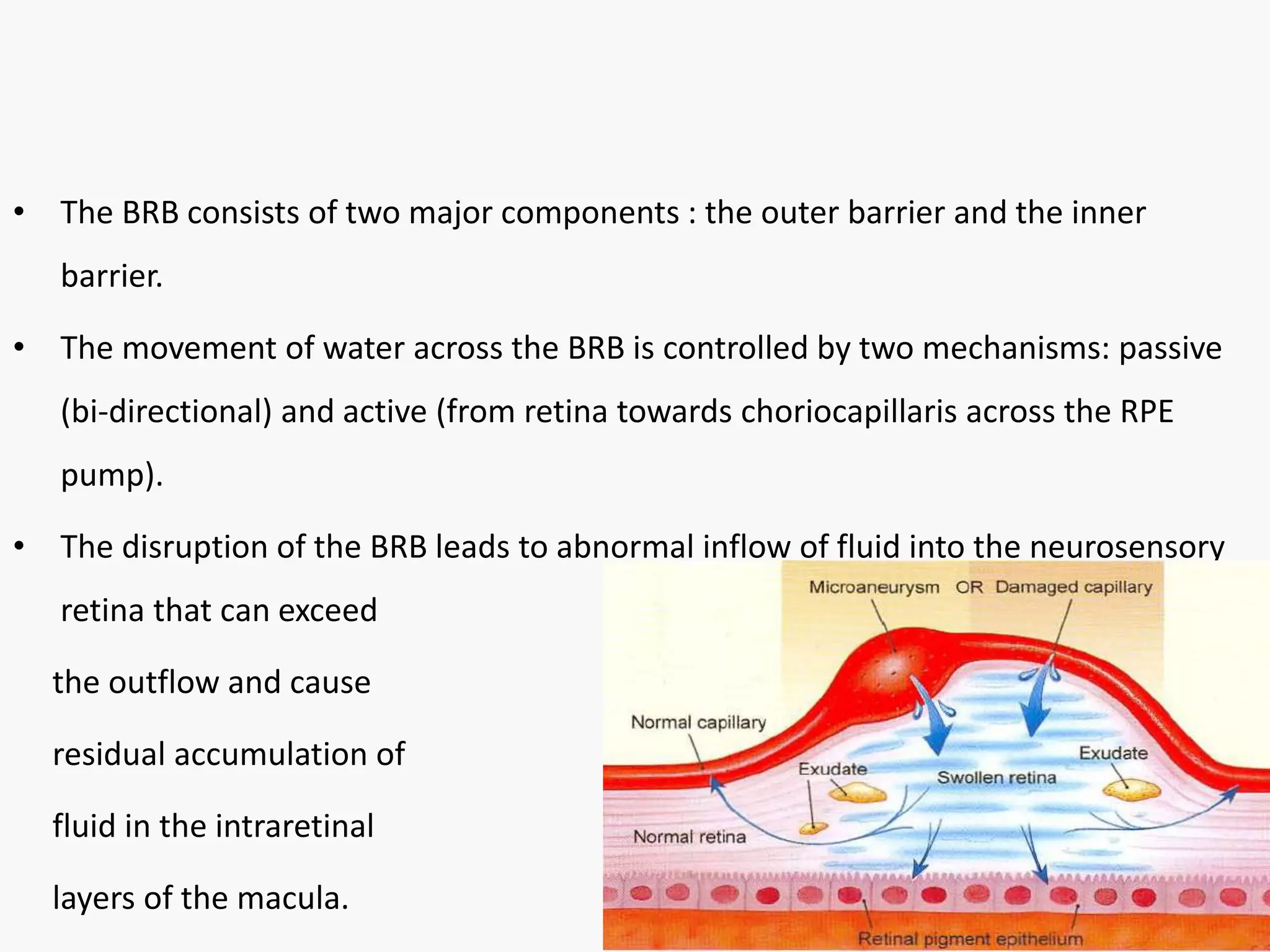 Diabetic macular edema | PPTX