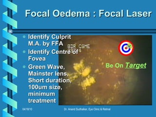 Diabetic Maculopathy1 Gos2 | PPT