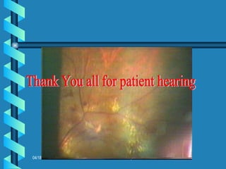 Diabetic Maculopathy1 Gos2 | PPT