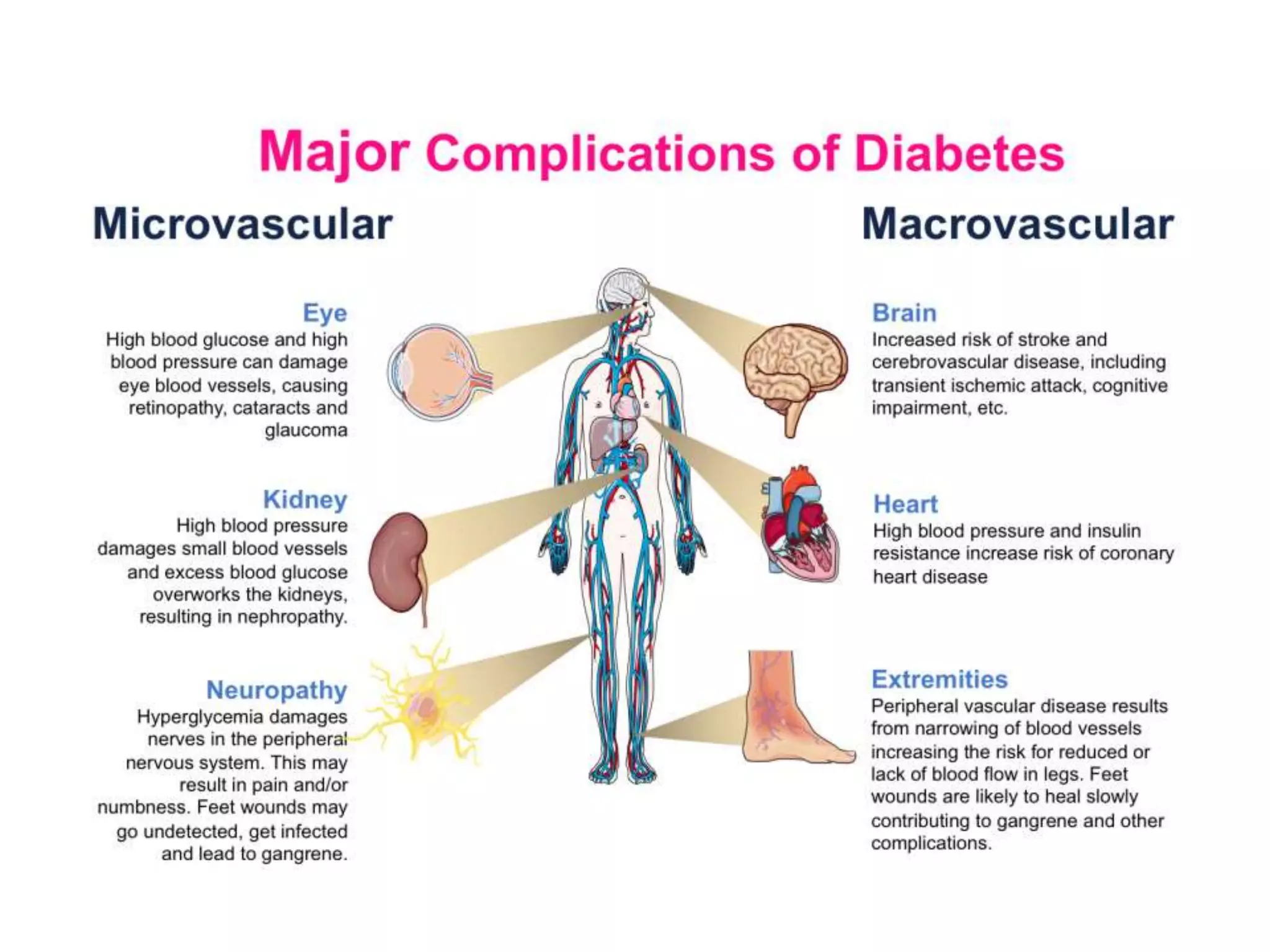 Diabetic mellitus pathophysiology | PPTX