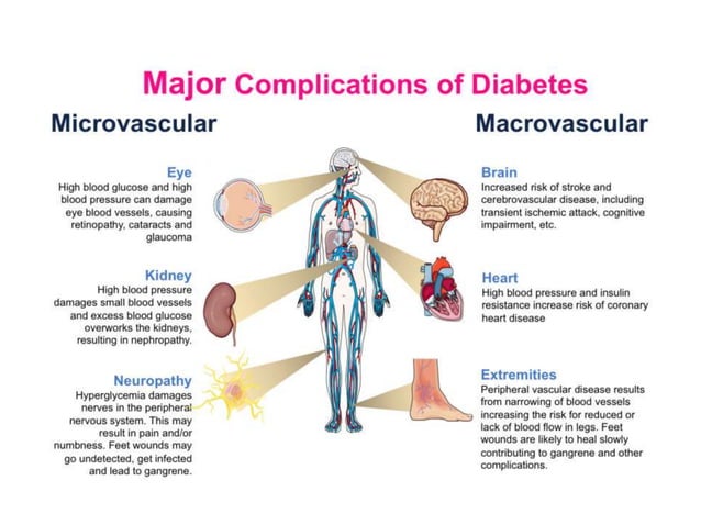 Diabetic mellitus pathophysiology | PPTX