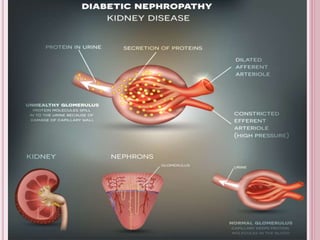 Diabetic nephropathy | PPT