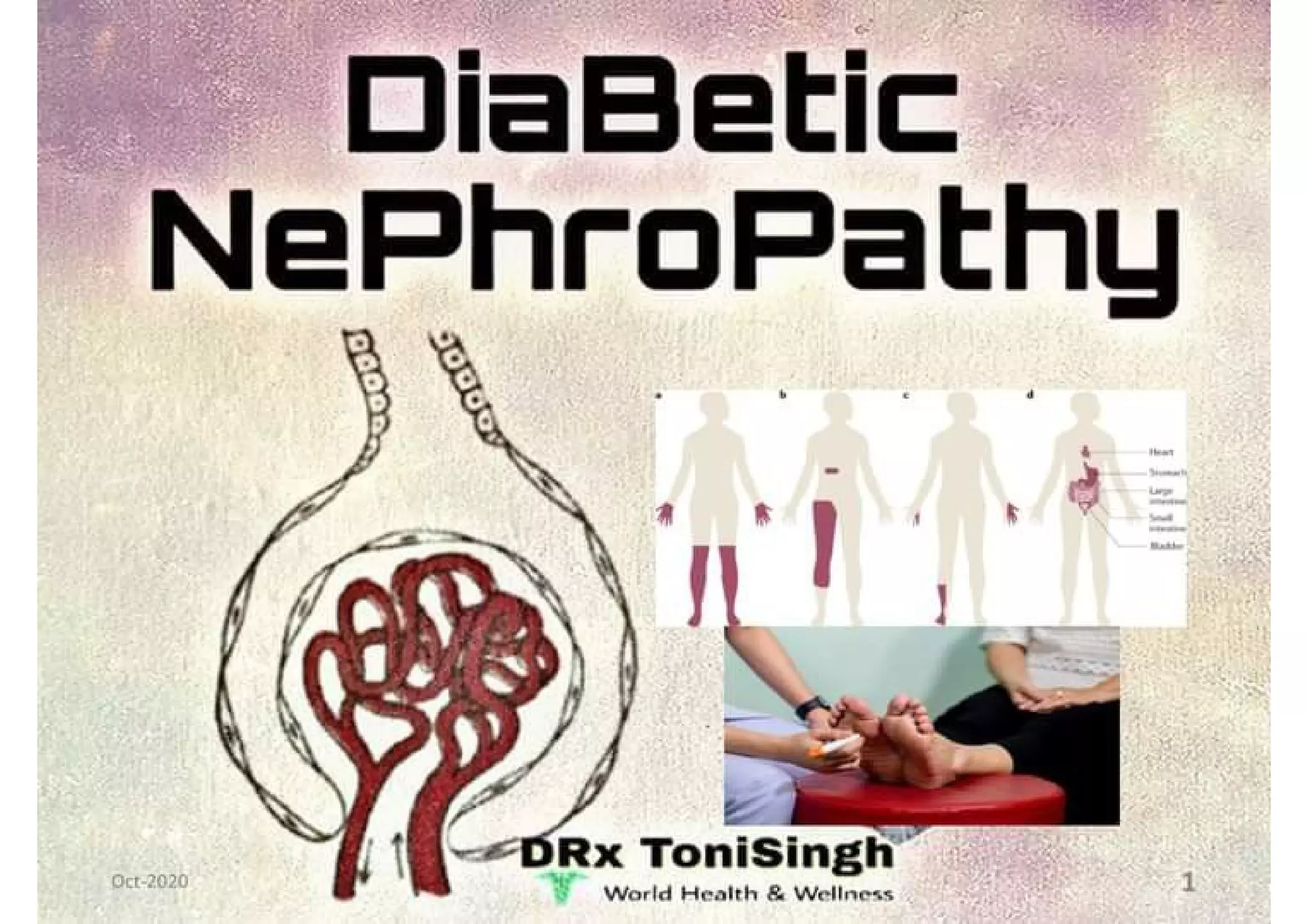 Diabetic Nephropathy | PPT