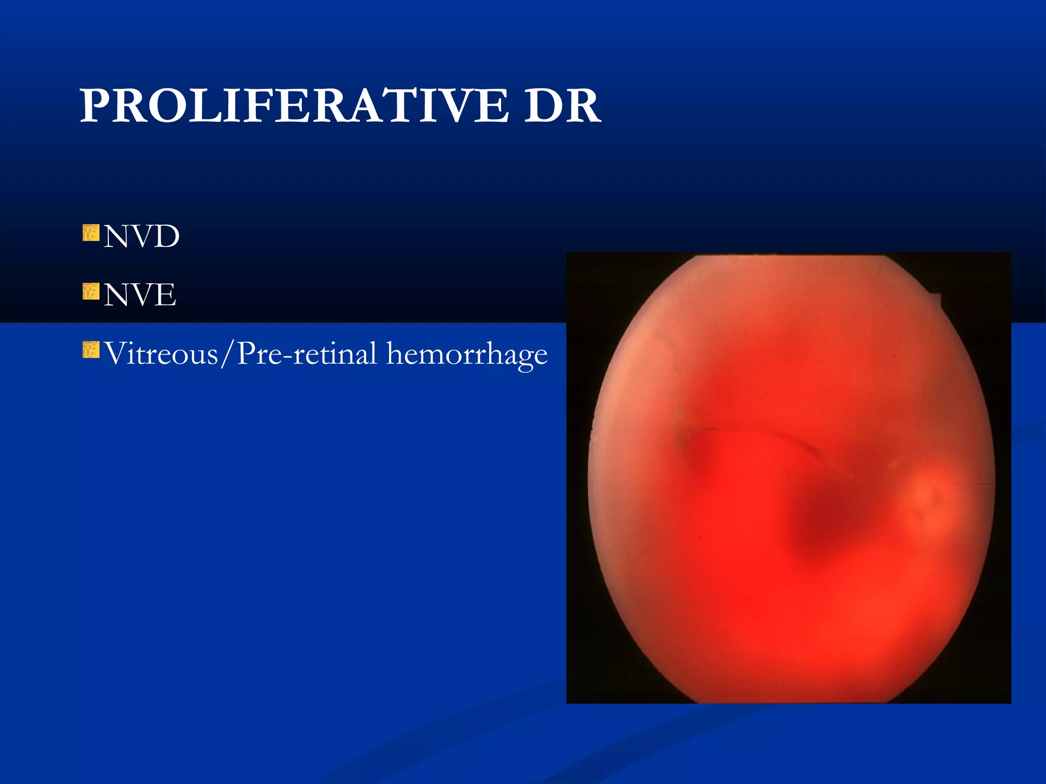 Diabetic ophthalmopathy | PPT
