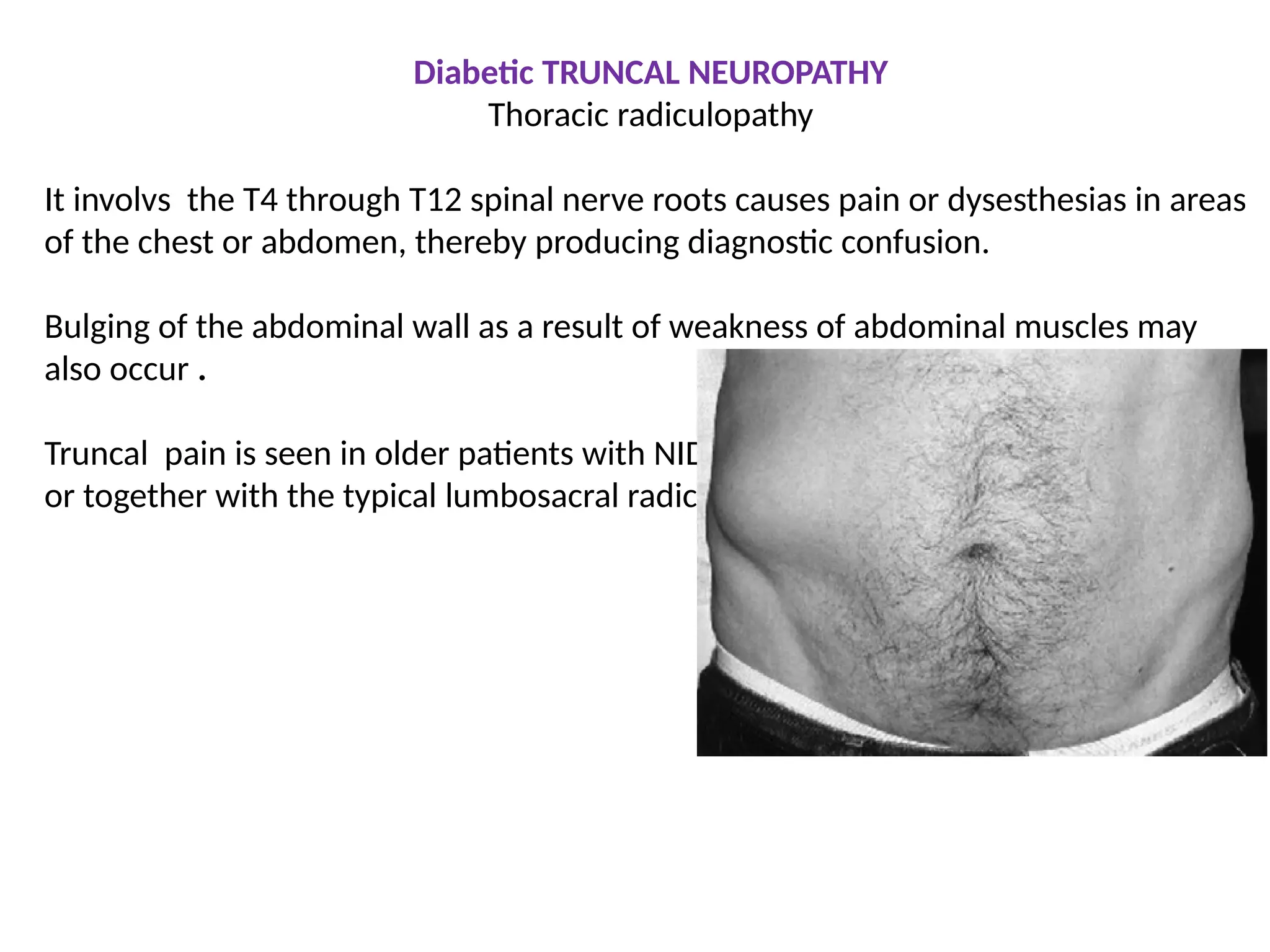 Diabetic_poly_neuropathy approach for diagnosis | PPTX