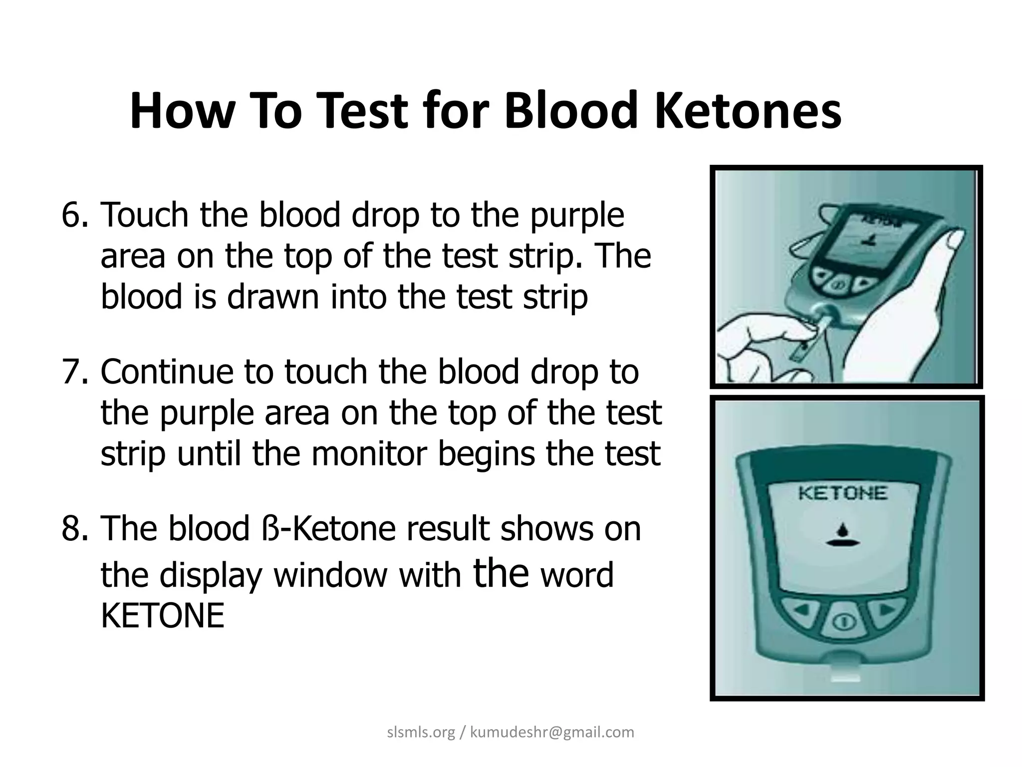 Diabetic Profile - Lab Diagnosis | PPTX