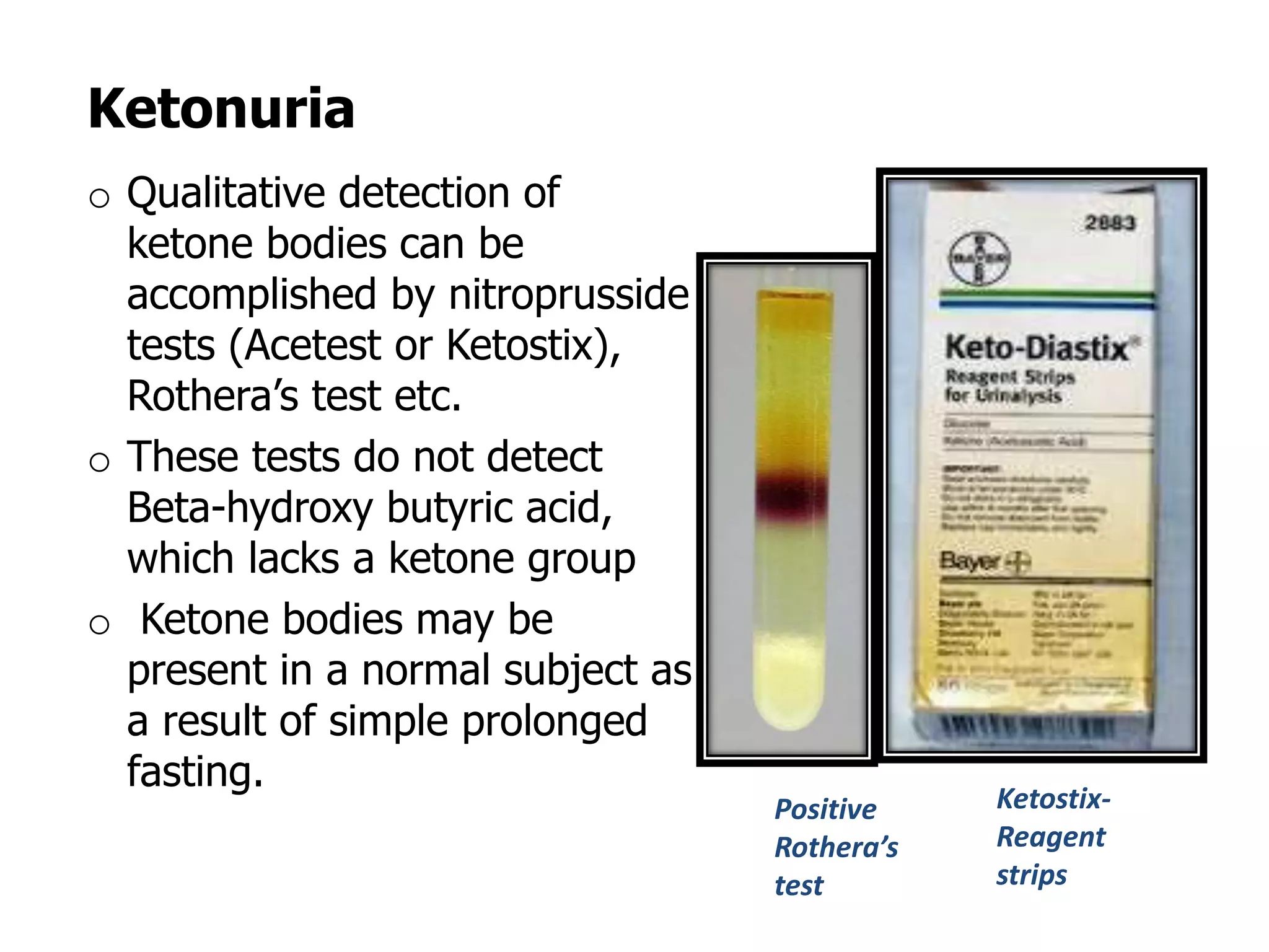 Diabetic Profile - Lab Diagnosis | PPTX