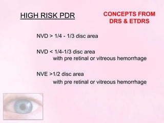 Diabetic retinopathy | PPTX