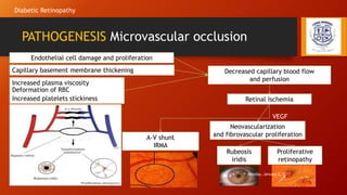 Diabetic retinopathy | PPTX