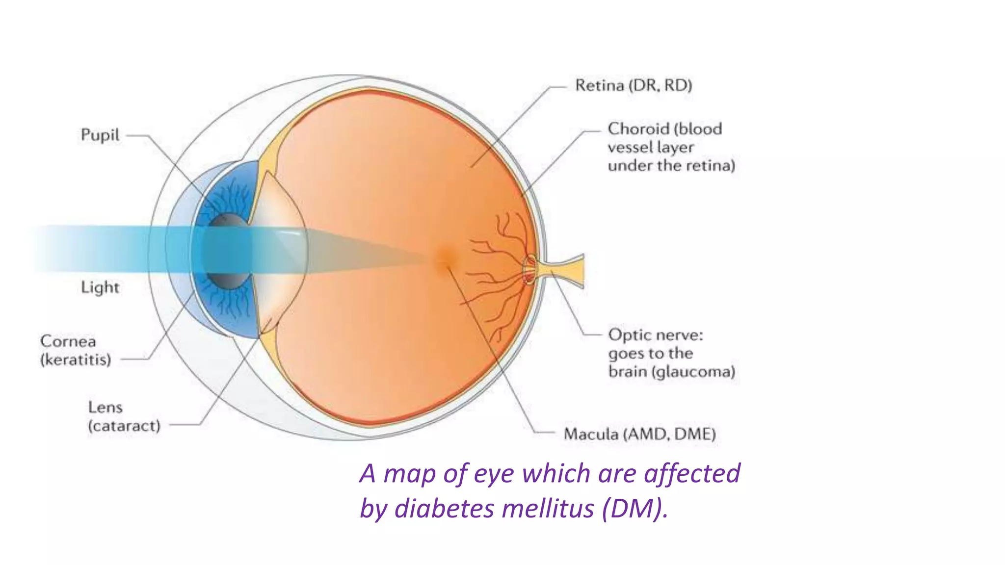 Diabetic retinopathy | PPT