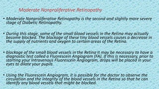 Diabetic retinopathy | PPT