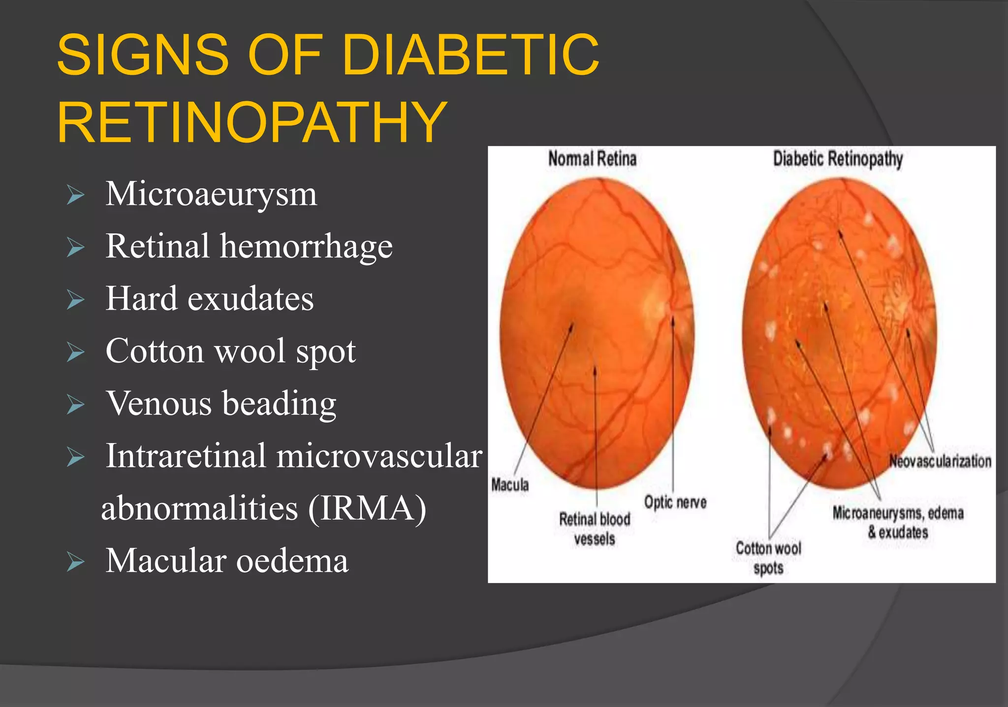 Diabetic retinopathy | PPTX