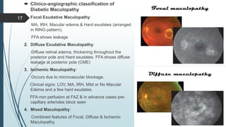 Diabetic retinopathy | PPTX