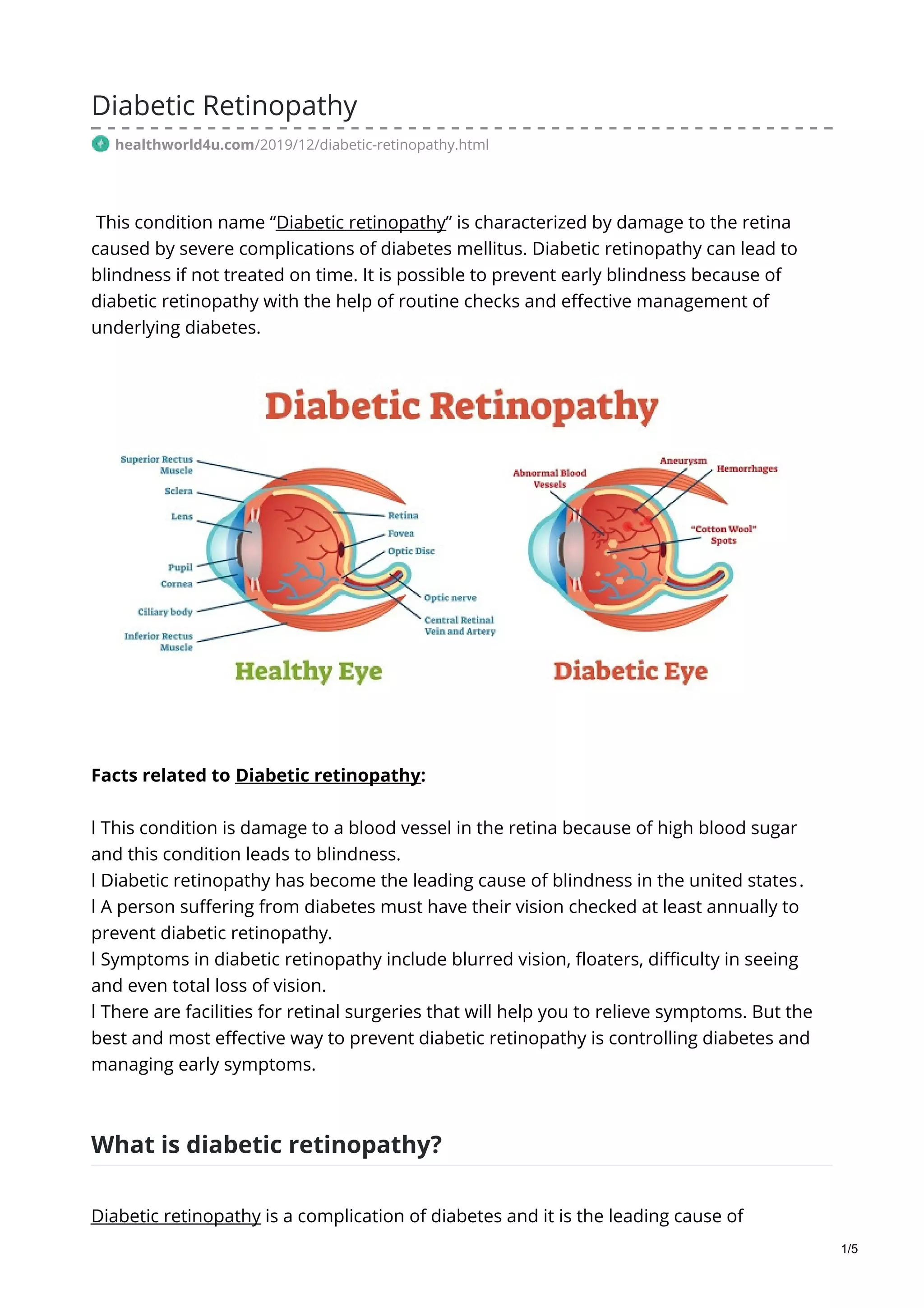 Diabetic retinopathy | PDF