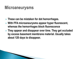 Diabetic retinopathy | PPTX