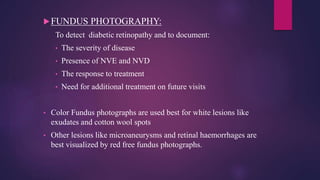 Diabetic retinopathy and Hallmark studies | PPTX