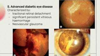 Diabetic Retinopathy - Presentation .pptx